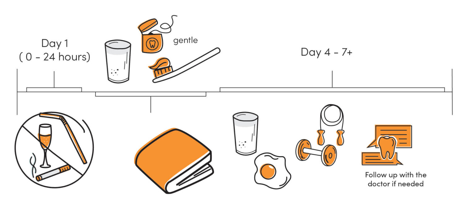 How to Avoid Dry Sockets After a Tooth Extraction - Dentistry