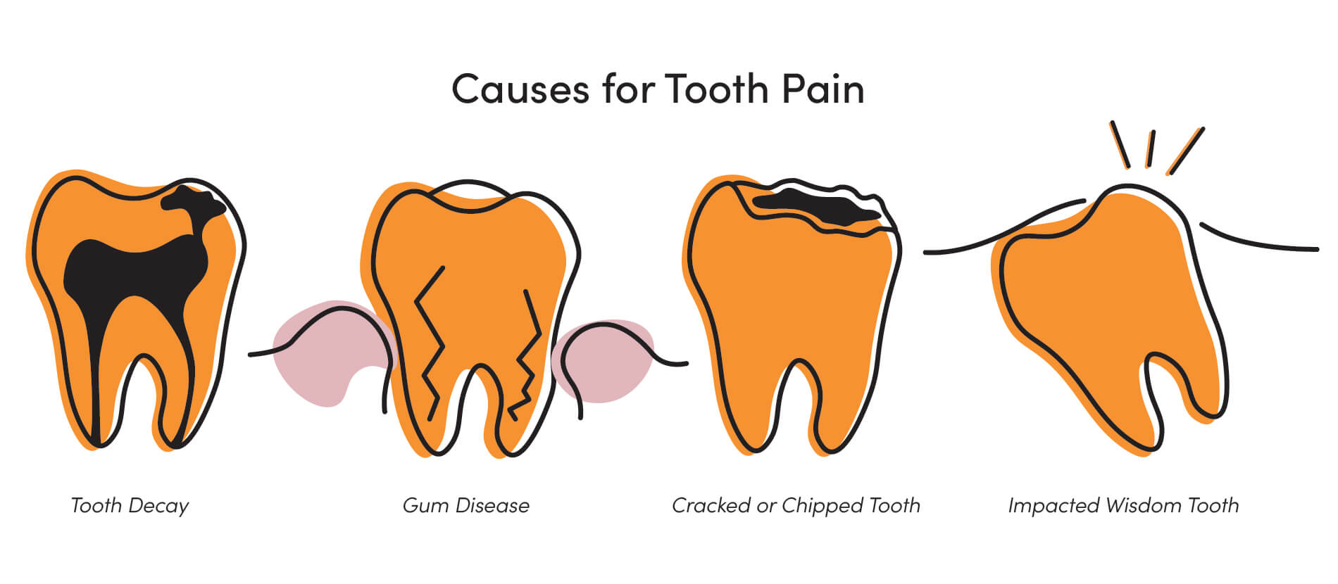 Can You Go to the ER for Tooth Pain? When It's Worth It and What to ...