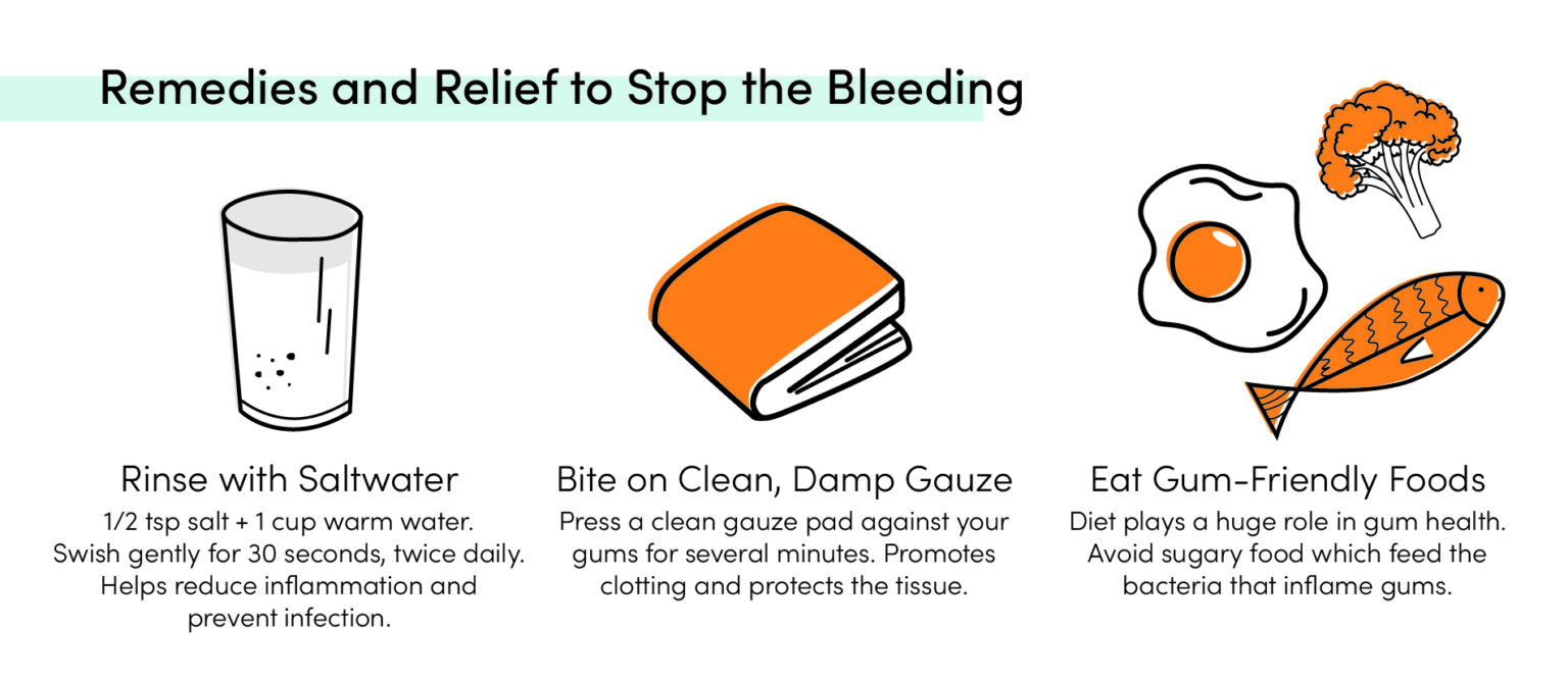 Home Remedies for Bleeding Gums - Dentistry