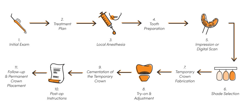 Temporary Crown Procedure: What Happens, How Long It Takes, and ...